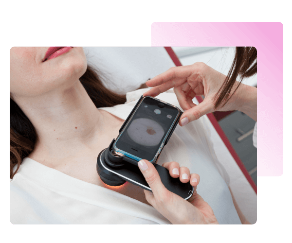 Disderm | Telediagnóstico en dermatologia para centros sanitarios